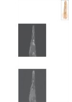 Cross Section of the Hand and Finger: Sagittal View