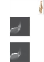Cross Section of the Thumb: Sagittal View