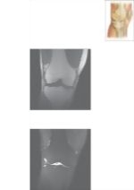 Cross Section of the Knee: Coronal View