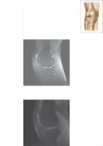 Cross Section of the Knee: Sagittal View