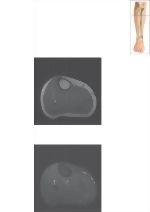 Cross Section of the Lower Leg: Axial View
