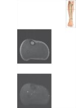 Cross Section of the Lower Leg: Axial View