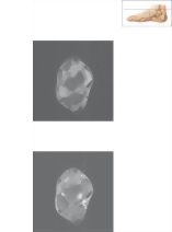 Cross Section of the Ankle and Foot: Axial View