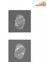 Cross Section of the Ankle and Foot: Axial View