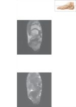 Cross Section of the Ankle and Foot: Axial View