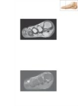 Cross Section of the Ankle and Foot: Coronal View
