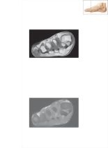 Cross Section of the Ankle and Foot: Coronal View