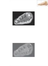 Cross Section of the Ankle and Foot: Coronal View