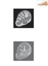 Cross Section of the Ankle and Foot: Coronal View