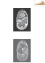 Cross Section of the Ankle and Foot: Coronal View
