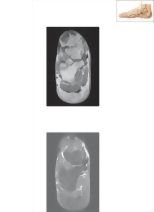 Cross Section of the Ankle and Foot: Coronal View