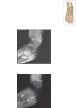 Cross Section of the Ankle and Foot: Coronal View