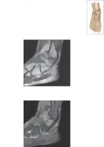 Cross Section of the Ankle and Foot: Coronal View