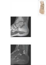 Cross Section of the Ankle and Foot: Coronal View