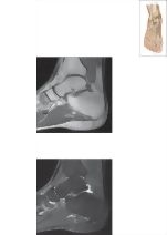 Cross Section of the Ankle and Foot: Coronal View