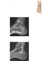 Cross Section of the Ankle and Foot: Coronal View