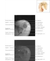 Cross Section of the Shoulder: Axial View