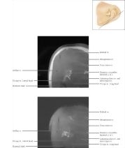Cross Section of the Shoulder: Coronal View