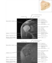 Cross Section of the Shoulder: Coronal View