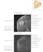 Cross Section of the Shoulder: Coronal View