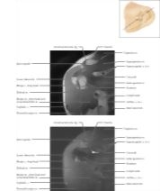 Cross Section of the Shoulder: Coronal View
