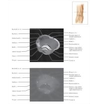 Cross Section of the Elbow: Axial View