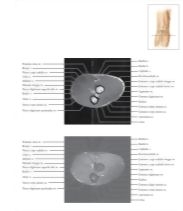 Cross Section of the Elbow: Axial View