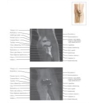 Cross Section of the Elbow: Coronal View