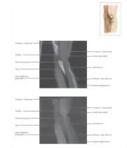 Cross Section of the Elbow: Coronal View