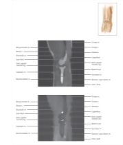 Cross Section of the Elbow: Sagittal View