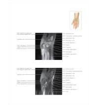 Cross Section of the Wrist: Sagittal View