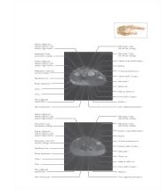 Cross Section of the Hand: Axial View