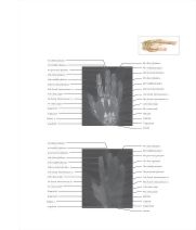 Cross Section of the Hand and Finger: Coronal View