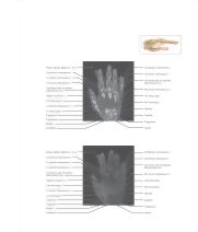 Cross Section of the Hand and Finger: Coronal View