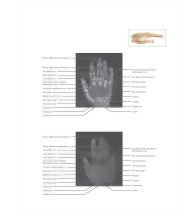 Cross Section of the Hand and Finger: Coronal View