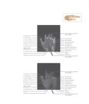 Cross Section of the Hand and Finger: Coronal View
