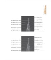 Cross Section of the Hand and Finger: Sagittal View