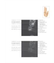 Cross Section of the Thumb: Axial View