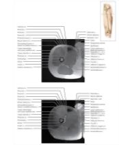 Cross Section of the Thigh: Axial View