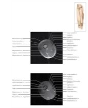 Cross Section of the Thigh: Axial View