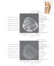 Cross Section of the Knee: Axial View