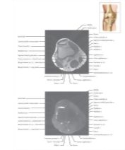Cross Section of the Knee: Axial View