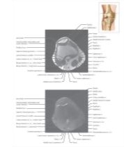 Cross Section of the Knee: Axial View