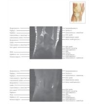 Cross Section of the Knee: Coronal View