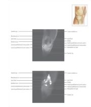 Cross Section of the Knee: Coronal View