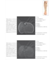 Cross Section of the Lower Leg: Axial View