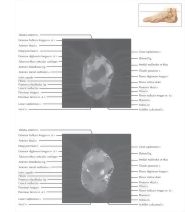 Cross Section of the Ankle and Foot: Axial View