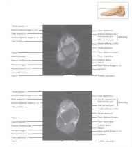 Cross Section of the Ankle and Foot: Axial View