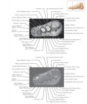 Cross Section of the Ankle and Foot: Coronal View