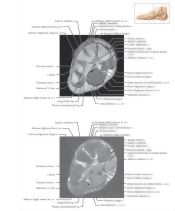 Cross Section of the Ankle and Foot: Coronal View